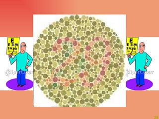 Colour Blindness Ishihara Charts | PPT