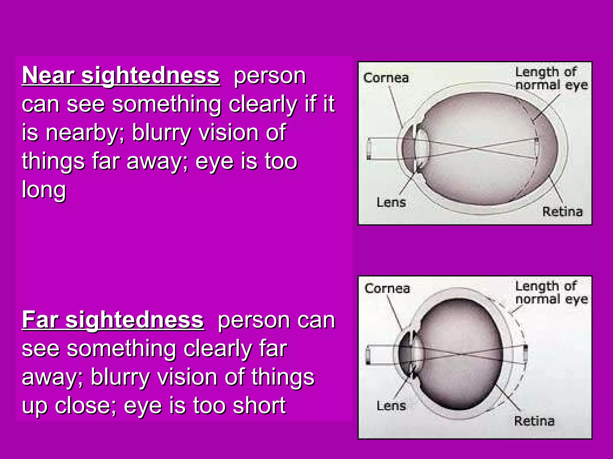 Physics 3 notes: light and sound mechanics including eyes, ears ...