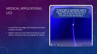 Wood’s Lamp Physics Assignment by Abdullah Sher | PPT