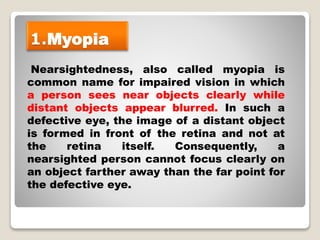 Physics class 10(Human eye){Diphu_ Abhinab Boruah} | PPTX