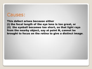 Physics class 10(Human eye){Diphu_ Abhinab Boruah} | PPTX