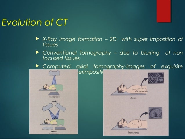 Physics of ct mri