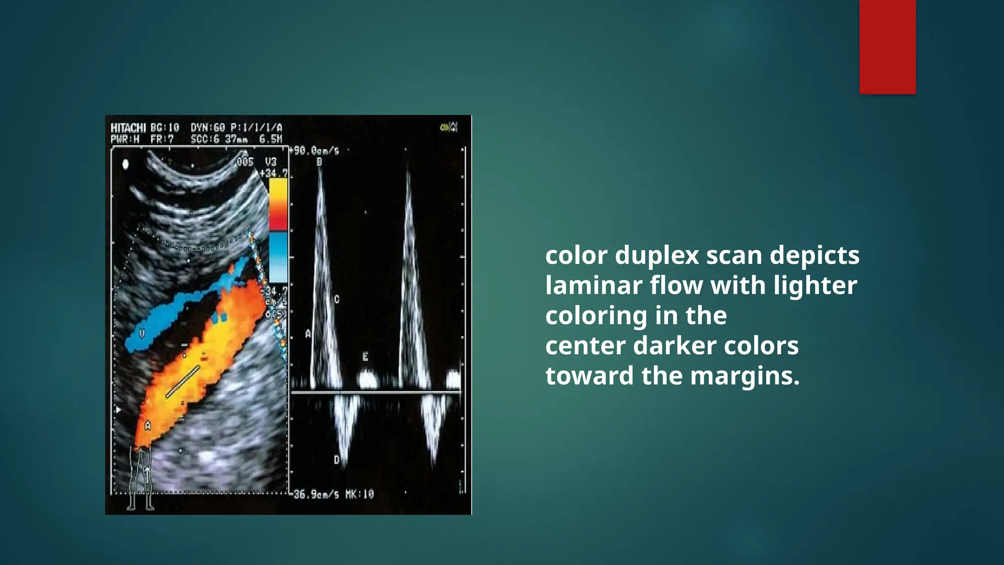 PHYSICS OF DOPPLER Doppler physics ultrasound | PPT