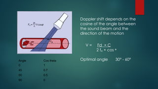 PHYSICS OF DOPPLER Doppler physics ultrasound | PPTX