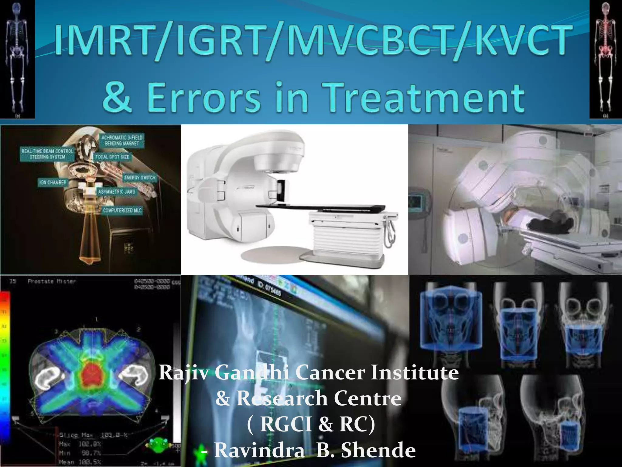 Intensity modulated radiation therapy and Image guided radiation ...