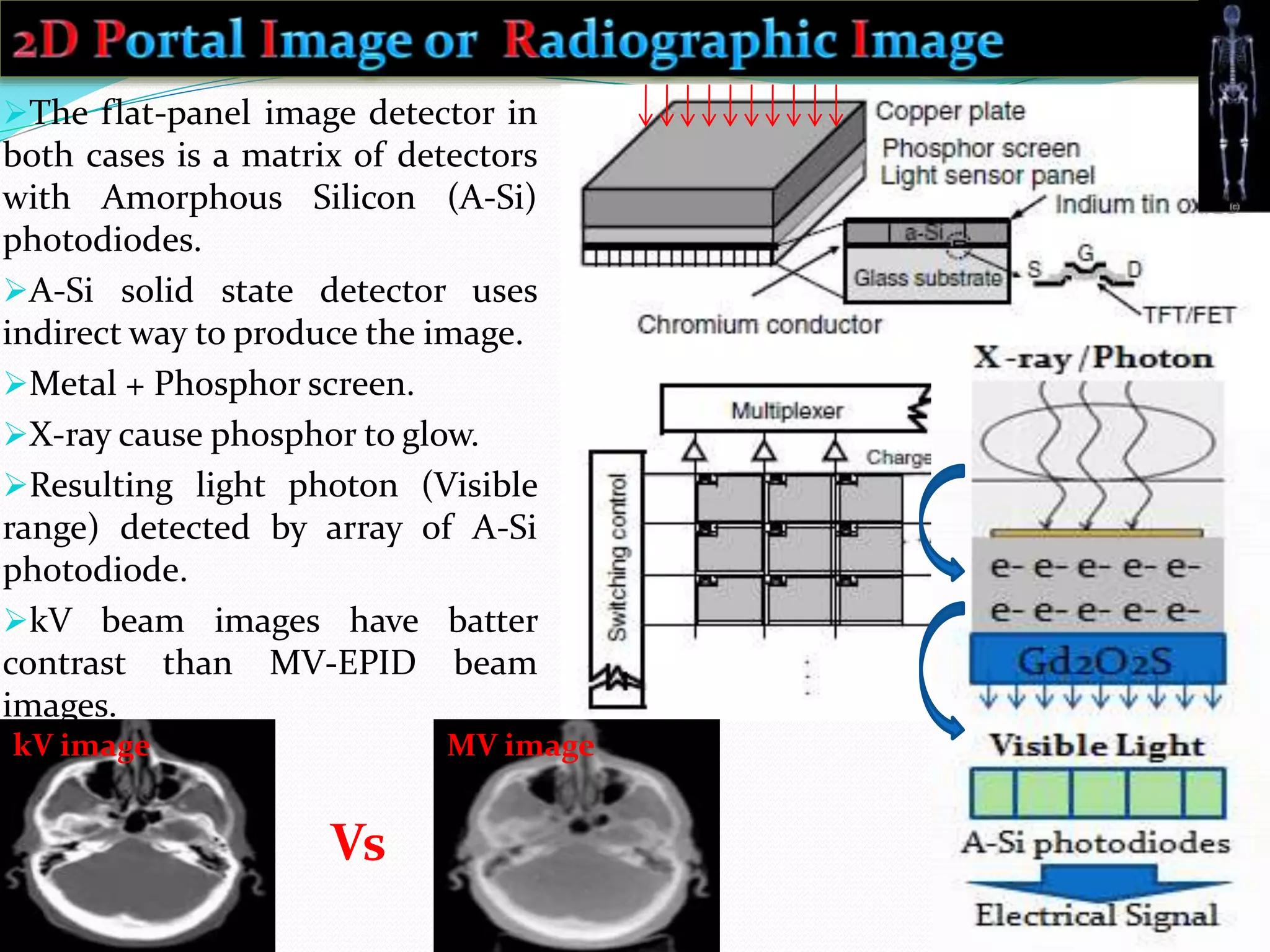 Intensity modulated radiation therapy and Image guided radiation ...