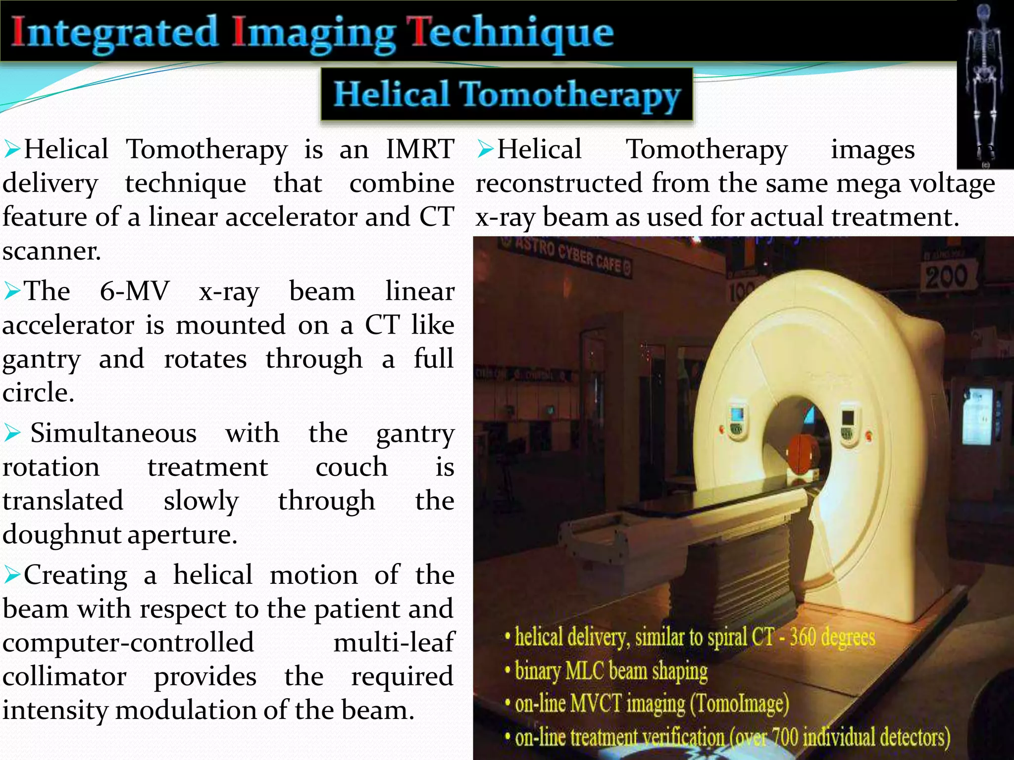 Intensity modulated radiation therapy and Image guided radiation ...