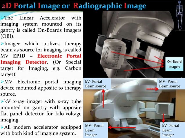 Intensity modulated radiation therapy and Image guided radiation ...