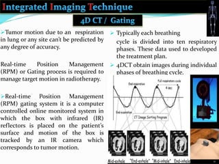 Intensity modulated radiation therapy and Image guided radiation ...