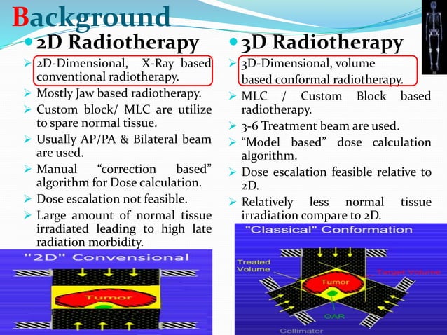 Intensity modulated radiation therapy and Image guided radiation ...