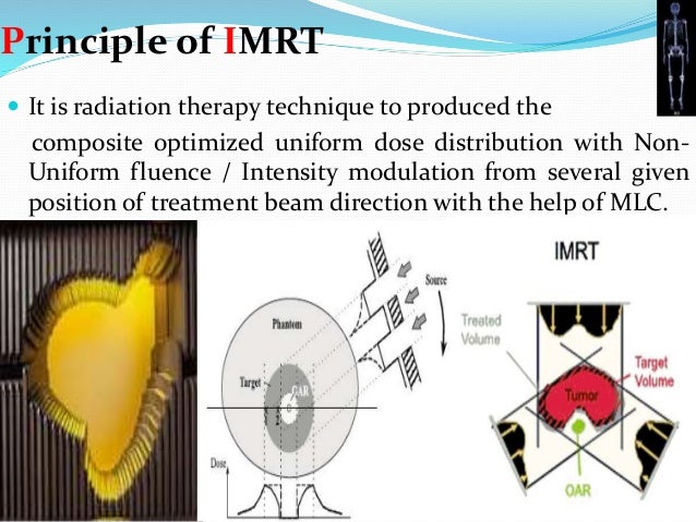 Intensity modulated radiation therapy and Image guided radiation ther…
