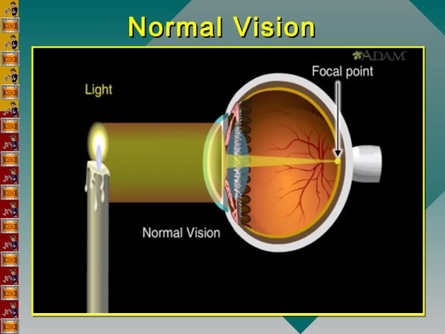 Physics of the Human Eye | PPT | Eye and Vision Conditions | Diseases ...