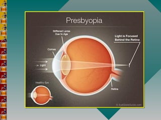 Physics of the Human Eye | PPT