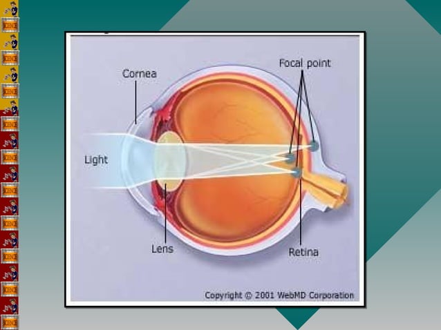 Physics of the Human Eye | PPT | Eye and Vision Conditions | Diseases ...
