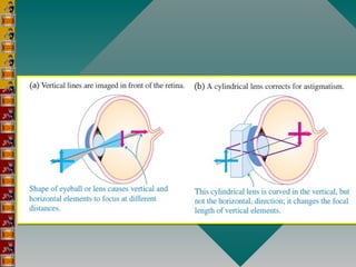 Physics of the Human Eye | PPT
