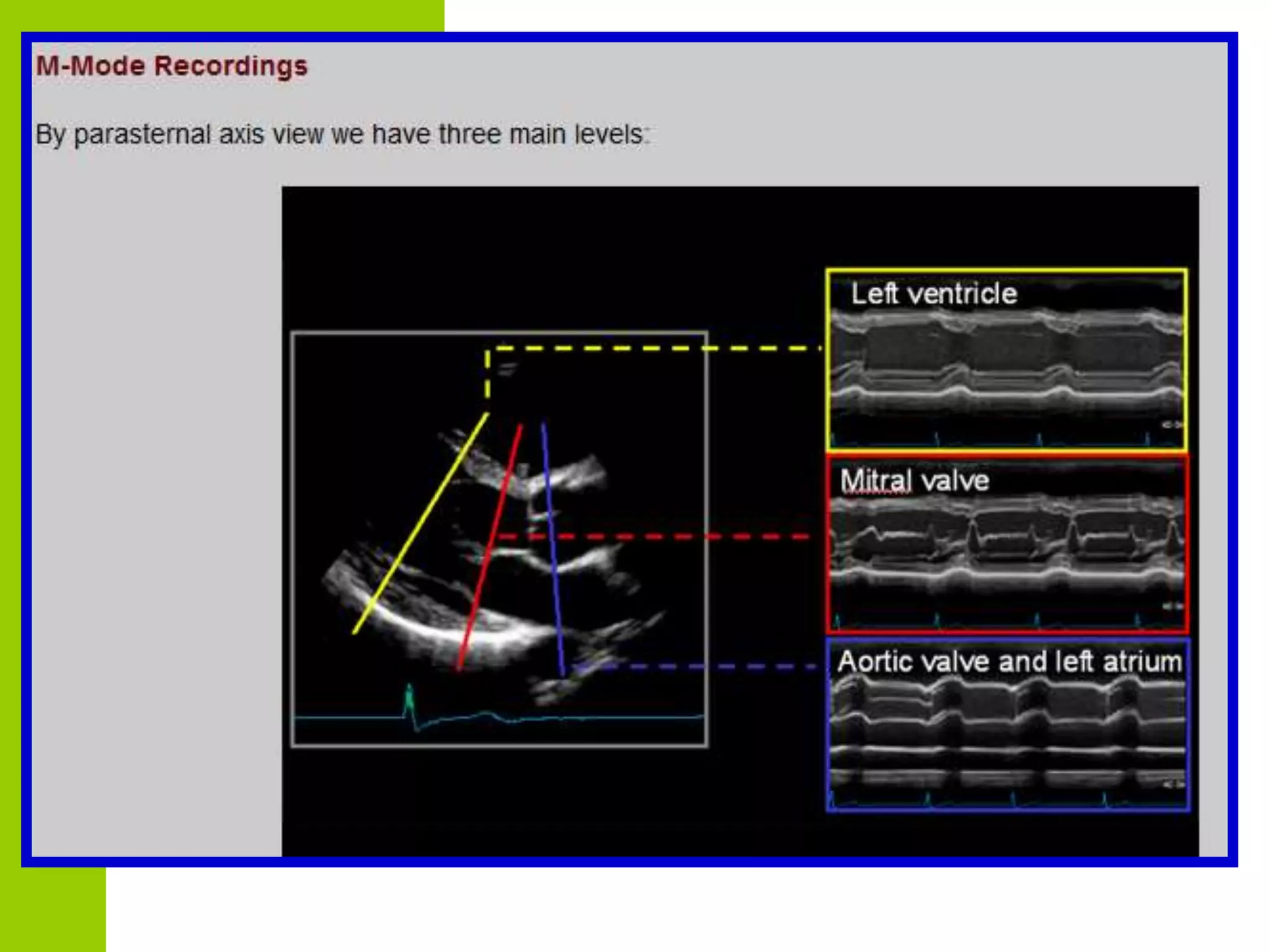 Physics of ultrasound and echocardiography | PPTX | Digital Audio | Computer Software and ...