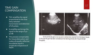 PHYSICS OF ULTRASOUND AND KNOBOLOGY | PPTX