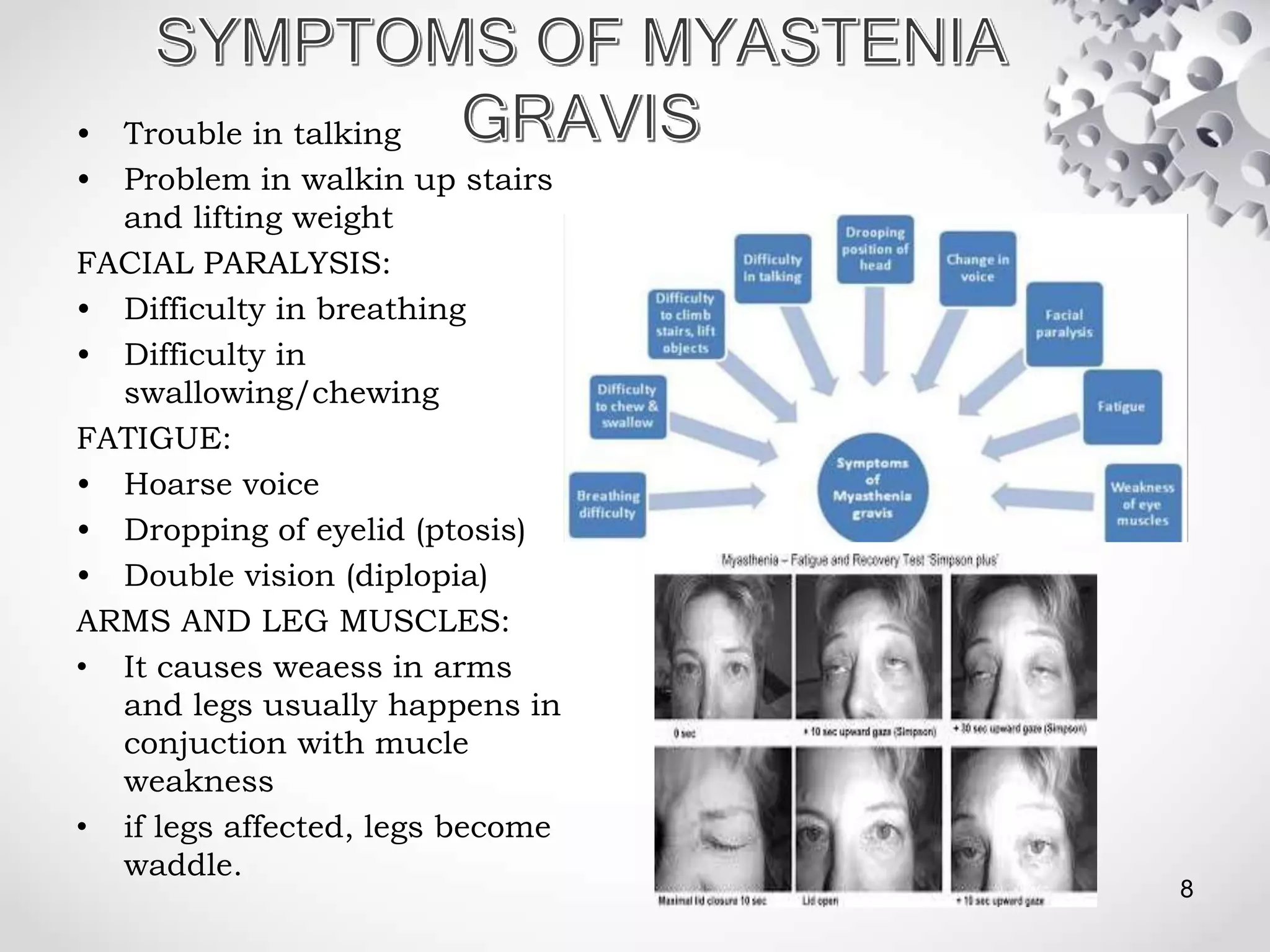 MYASTHENIA GRAVIS | PPT