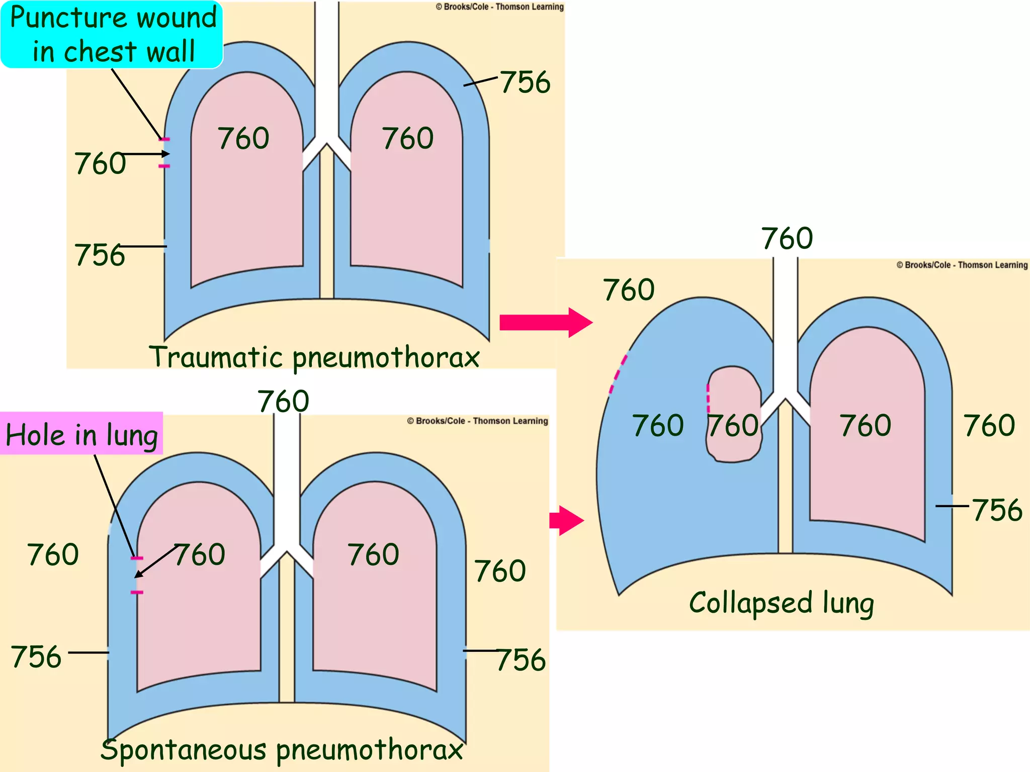 Physio chapter 13 lungs | PPT