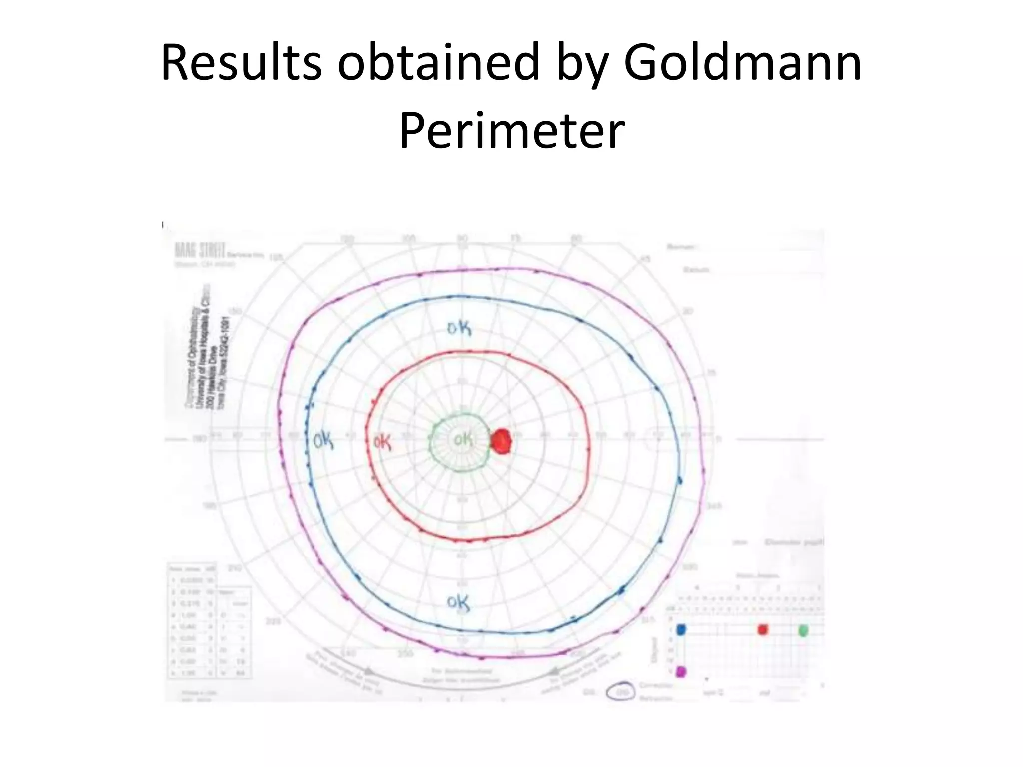 Physiolology of Eye: Power of Accommodation and Perimetry | PPTX