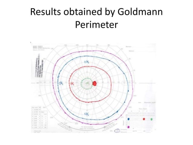 Physiolology of Eye: Power of Accommodation and Perimetry | PPT