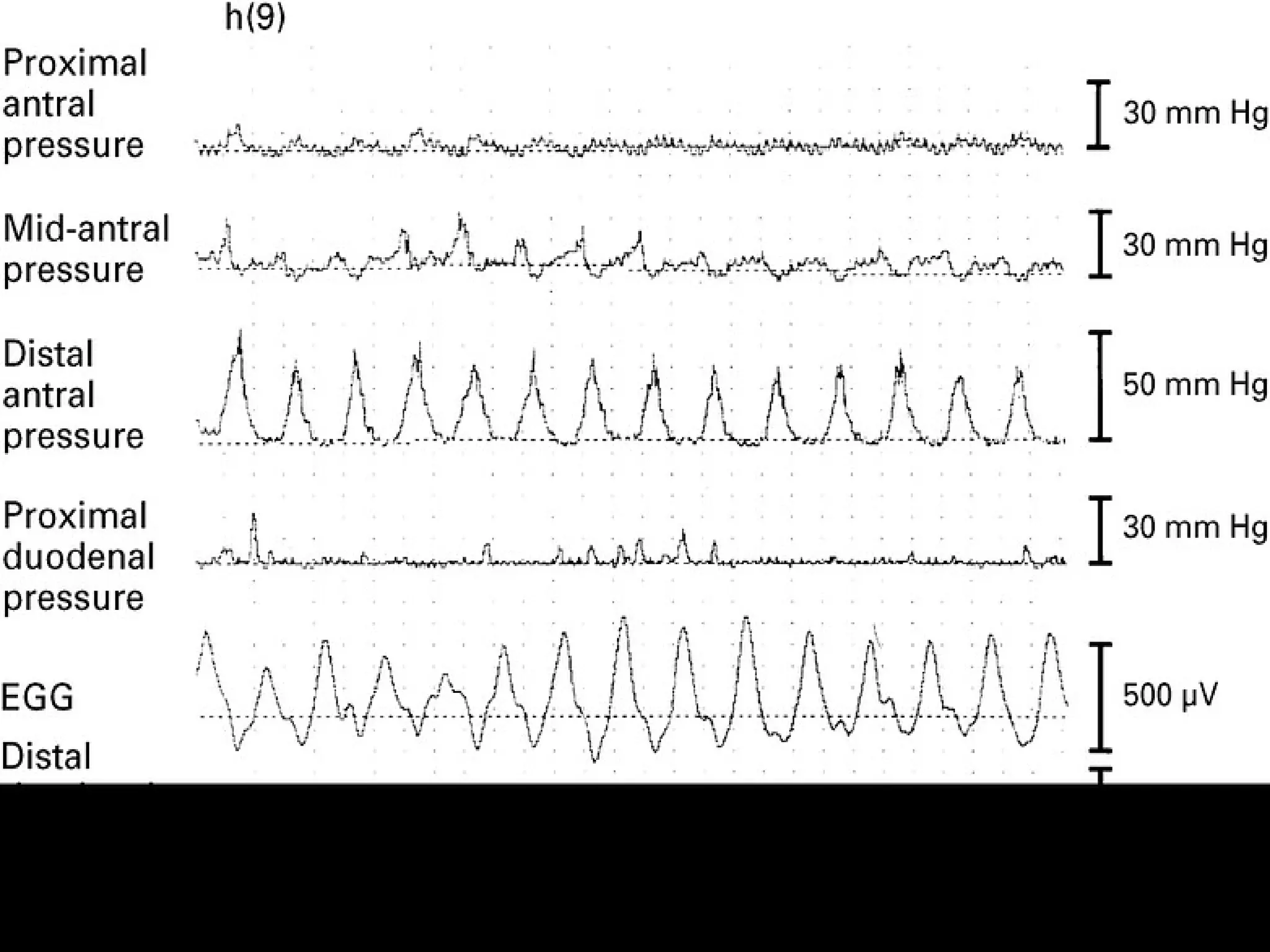 Physio git EGG. | PPT