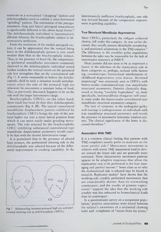 Physiognomy in classification of individuals with lateral preference in ...