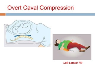 Physiological Changes During Pregnancy | PPSX