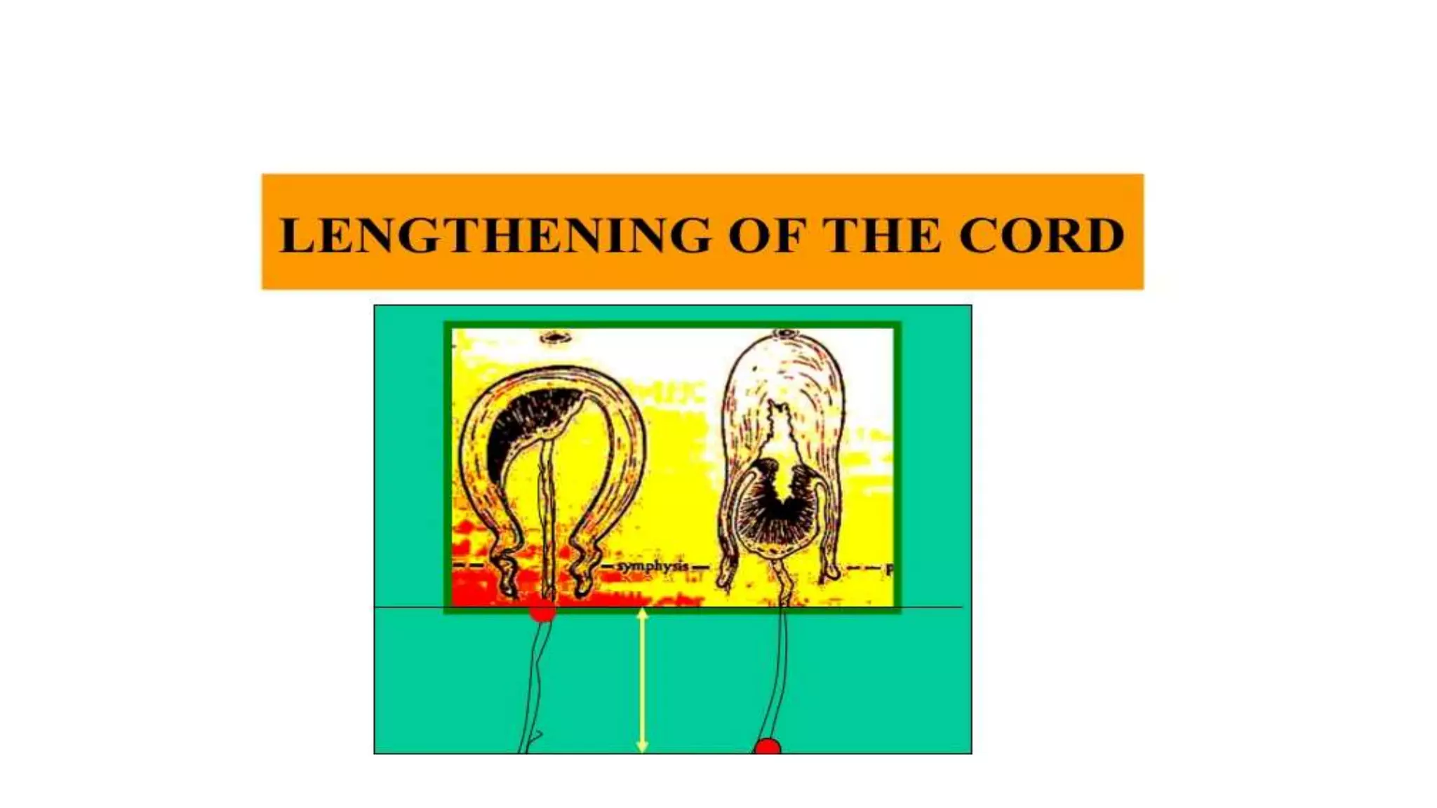 Physiological changes during third stage of labor | PPTX