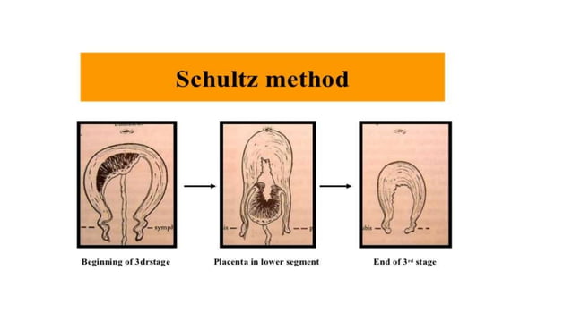 Physiological changes during third stage of labor | PPT