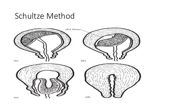 Physiological changes during third stage of labor