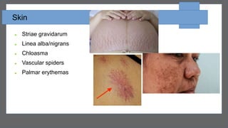 Physiological changes in pregnancy.ppt