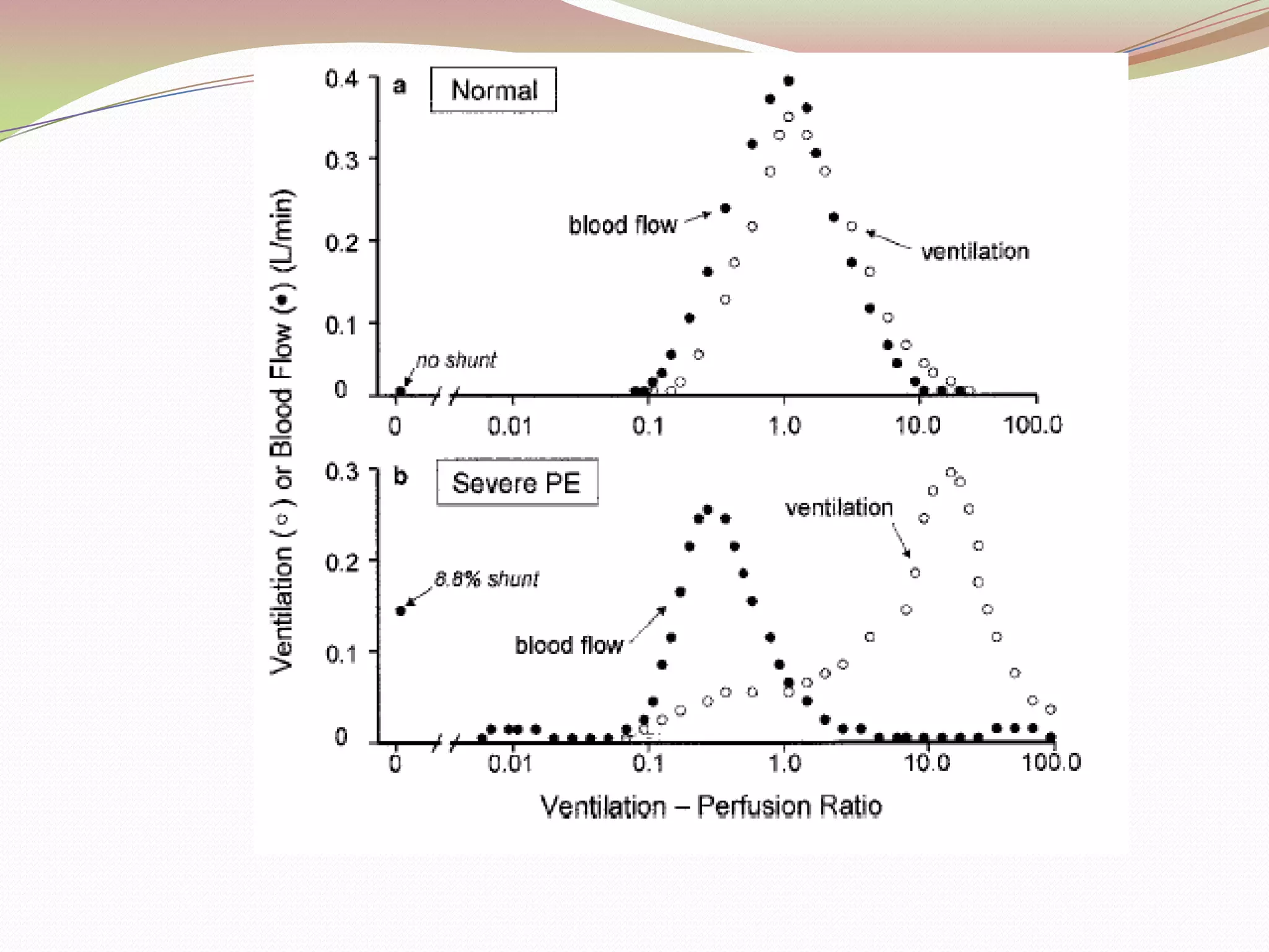 Physiological considerations and patient positioning during anesthesia ...