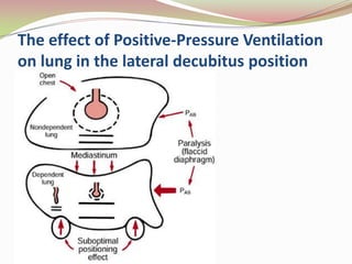 Physiological considerations and patient positioning during anesthesia ...