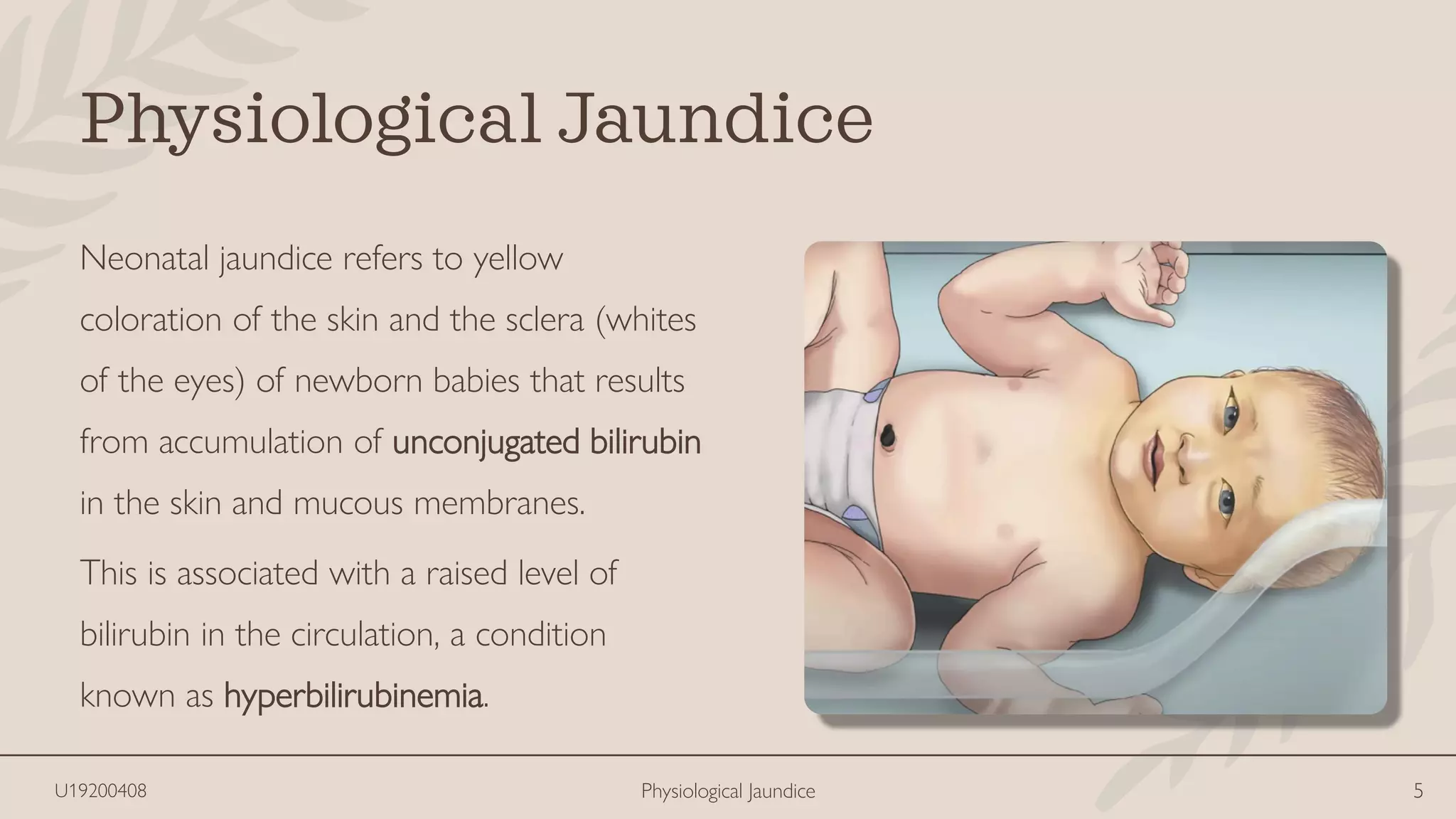 Physiological jaundice.pdf | Pregnancy | Reproductive Health