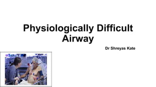 Physiologically difficult airway | PPTX