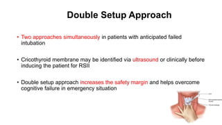 Physiologically difficult airway | PPTX