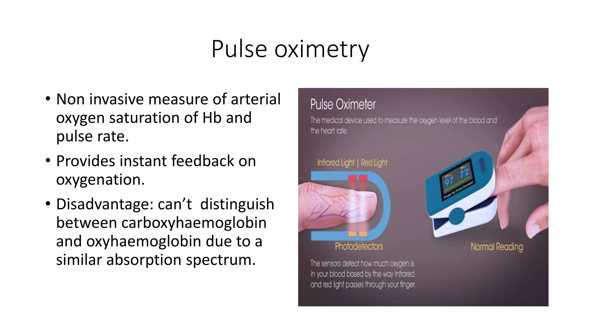 physiological monitoring of a surgical patient.pptx