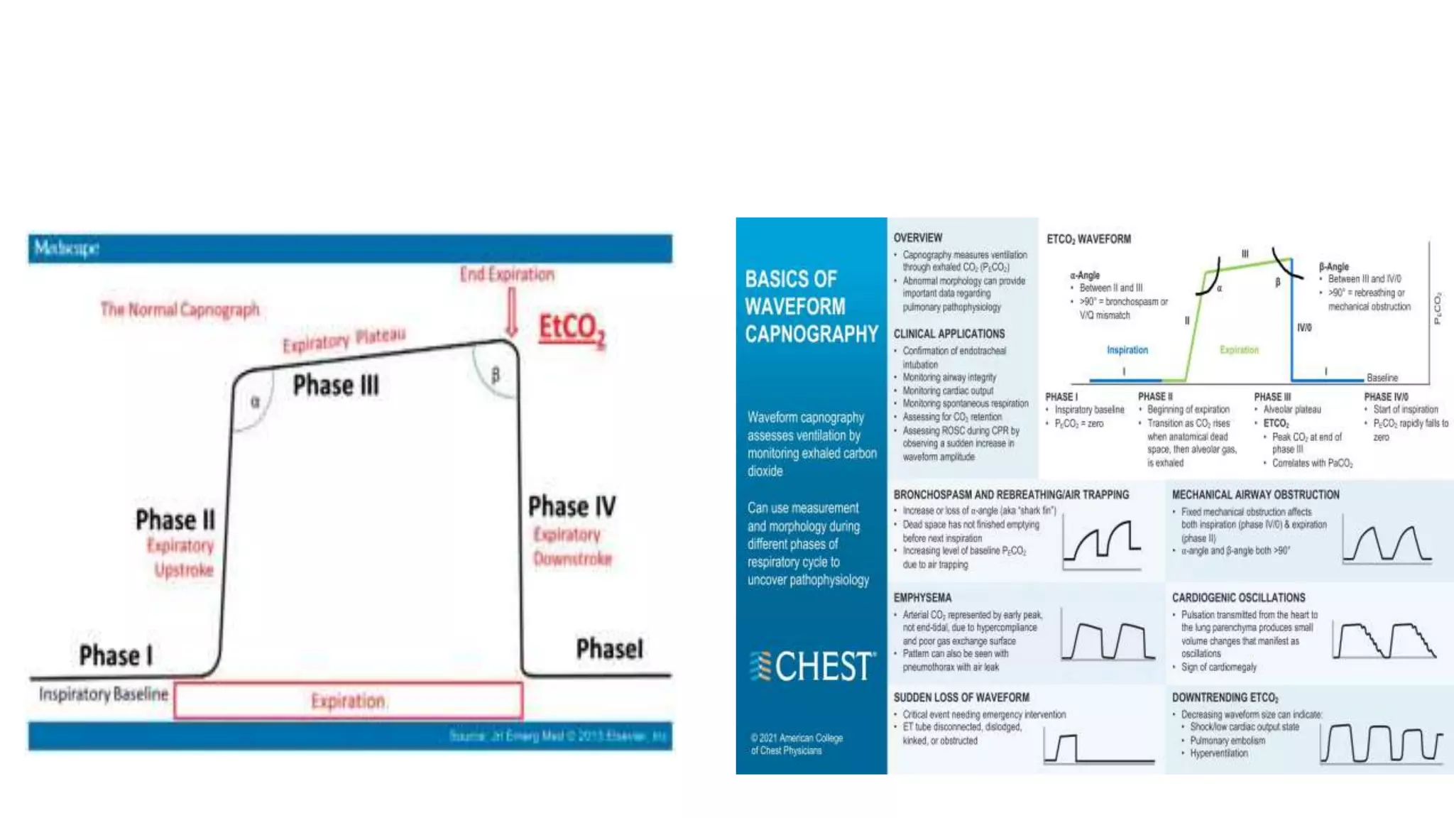 physiological monitoring of a surgical patient.pptx