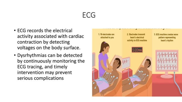 physiological monitoring of a surgical patient.pptx
