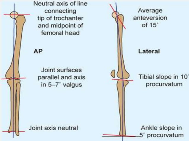 Physiological & pathological tibia vara | PPT | Death, Injury, or Military Conflict | Sensitive ...