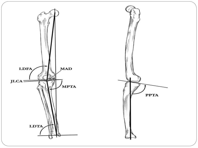 Physiological & pathological tibia vara | PPT | Death, Injury, or Military Conflict | Sensitive ...