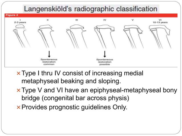 Physiological & pathological tibia vara | PPT | Death, Injury, or Military Conflict | Sensitive ...