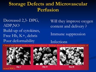 Physiological triggers for blood transfusion in the icu | PPT