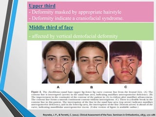Physiologic changes in smile and face with age | PPTX