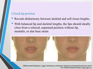 Physiologic changes in smile and face with age | PPTX
