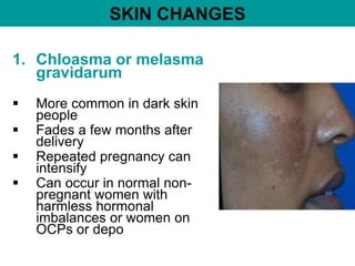 Physiologic changes of pregnancy | PPT