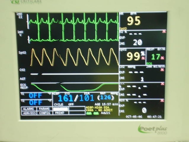 Physiologic Monitoring | PPT