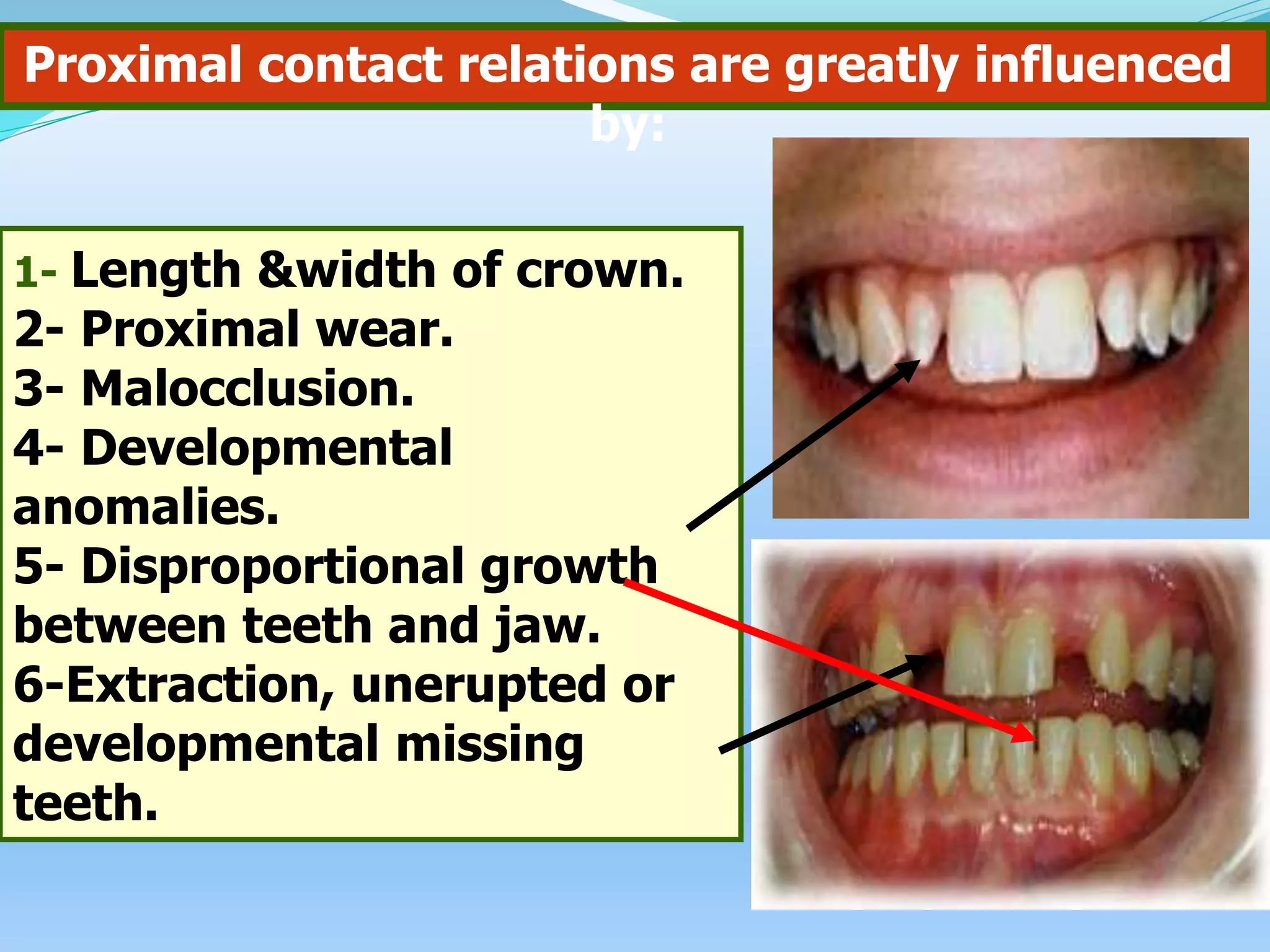 Physiologic tooth part 1 | PPTX