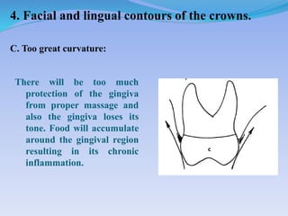 Physiologic tooth form part 2 | PPTX